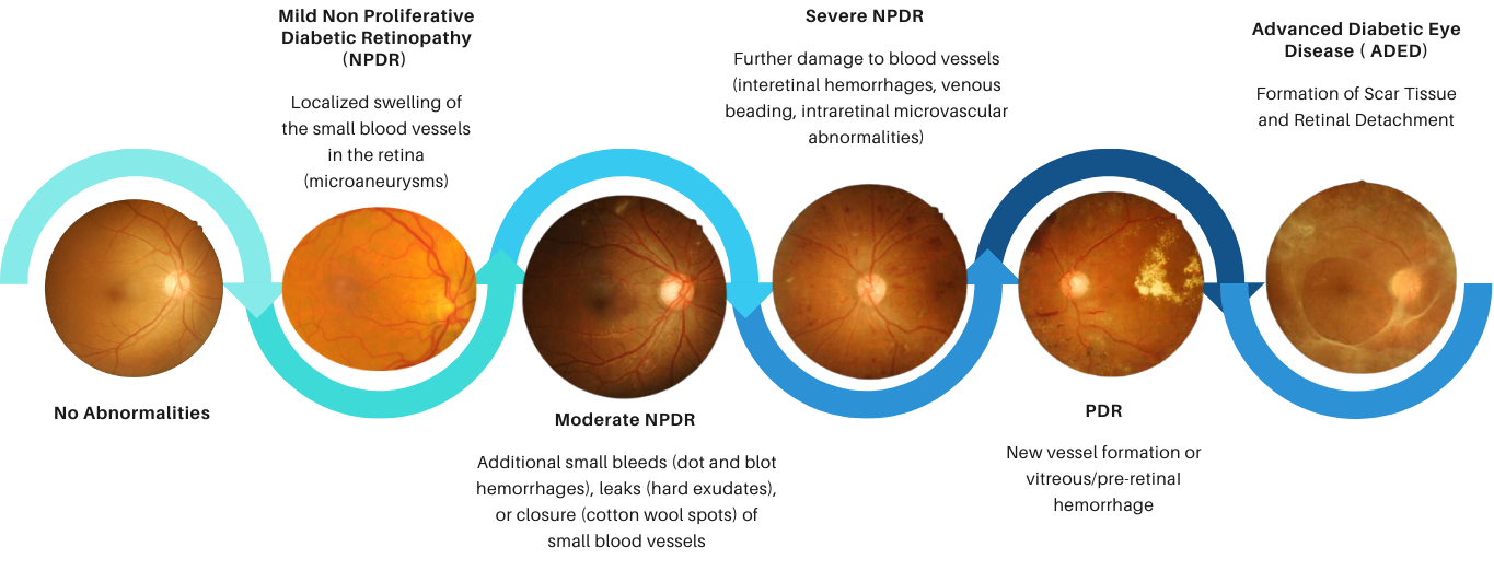 KL Eye Specialist Centre - Best Eye Specialist | Kuala Lumpur
